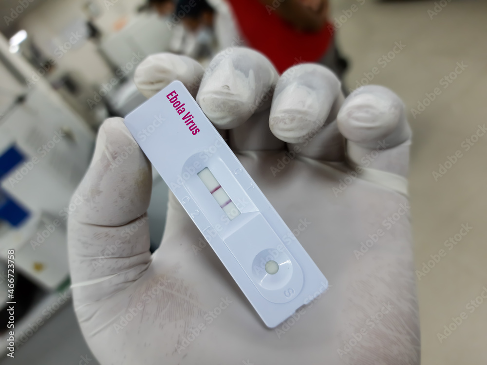 Quick rapid diagnostic test with positive results of Ebola virus test ...