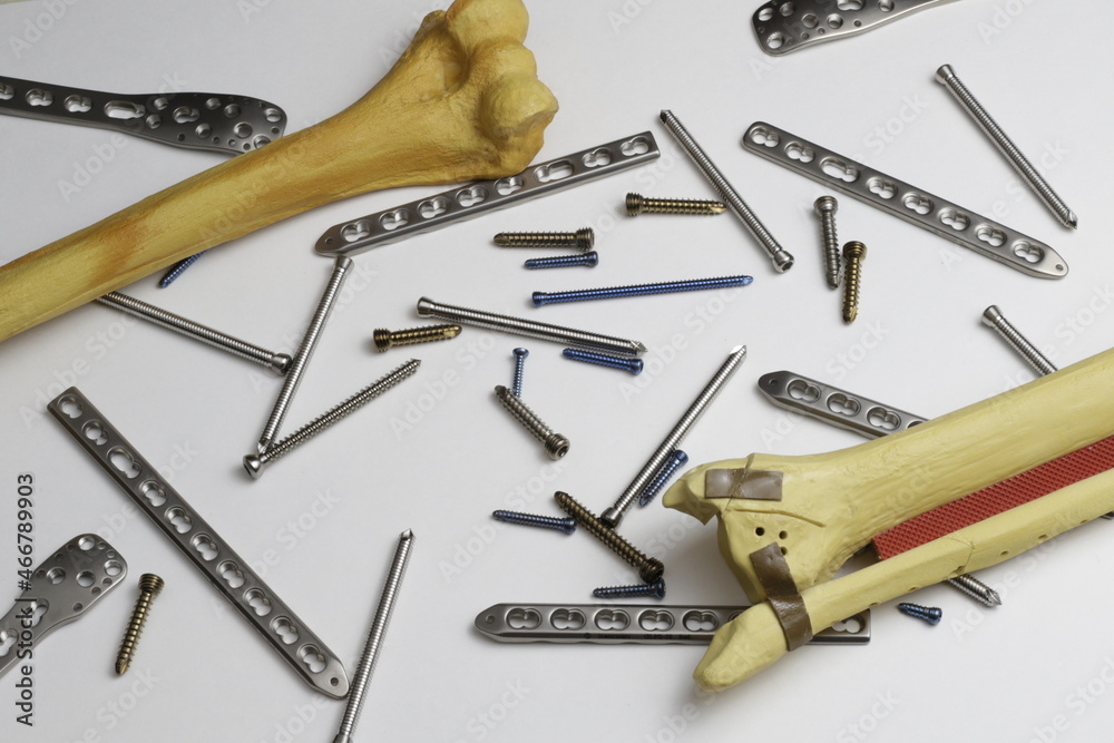 Surgical plates and instruments for osteosynthesis of bone fractures ...