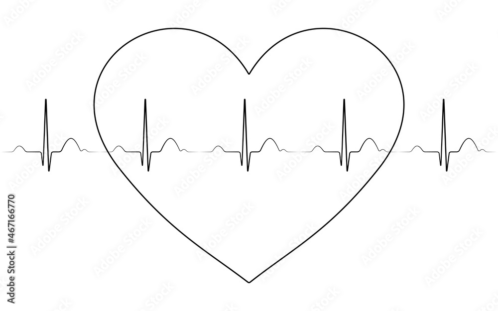 ECG. The heart beat like a black line on a white background. Pulse ...