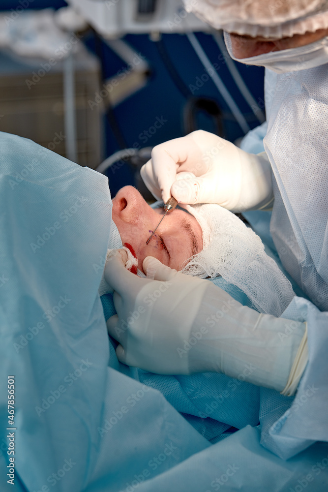 Close up of the face of a patient who is undergoing blepharoplasty. The ...