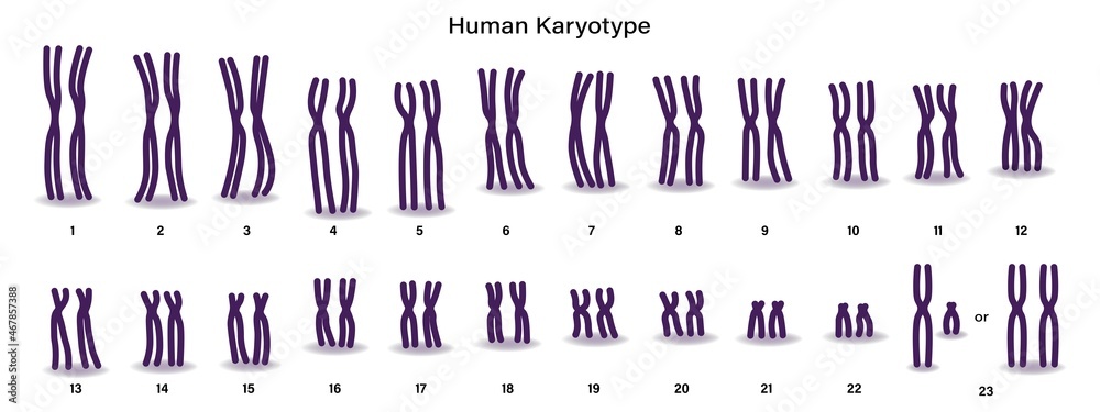 Chromosome. Human karyotype. Male and Female. Biological study. Stock ...
