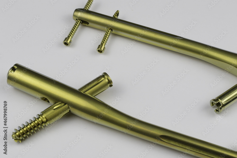 Gamma nail in case of treatment of proximal hip fracture Stock Photo ...