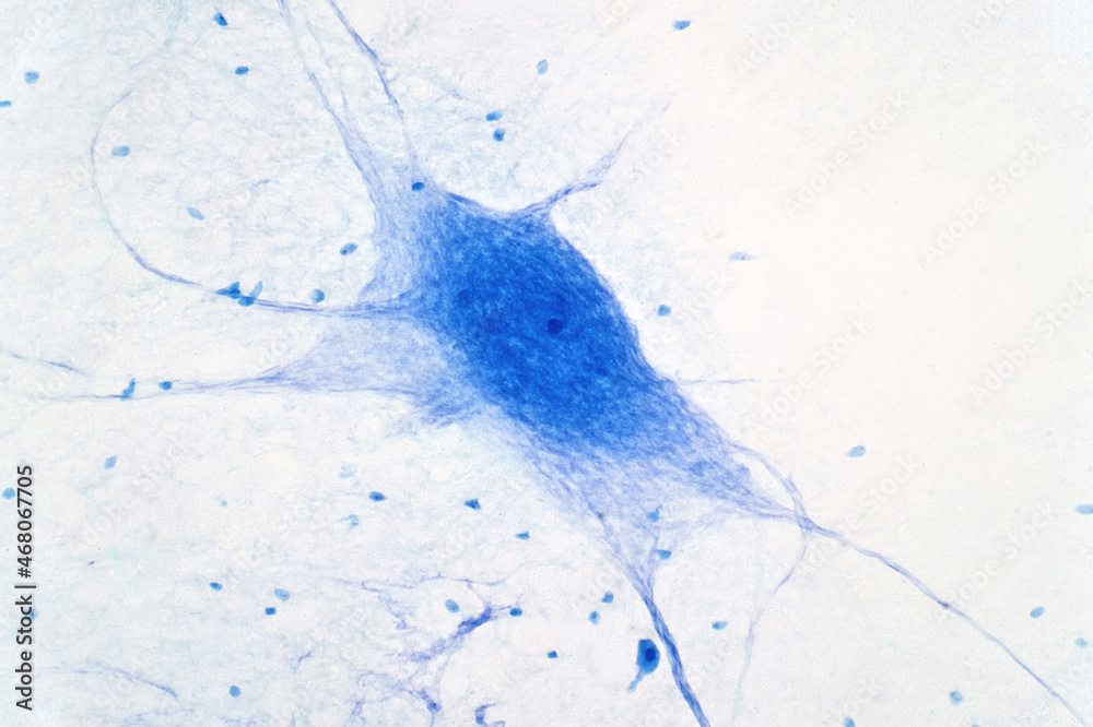 Neurons cells from the brain under the microscope view. Stock Photo ...