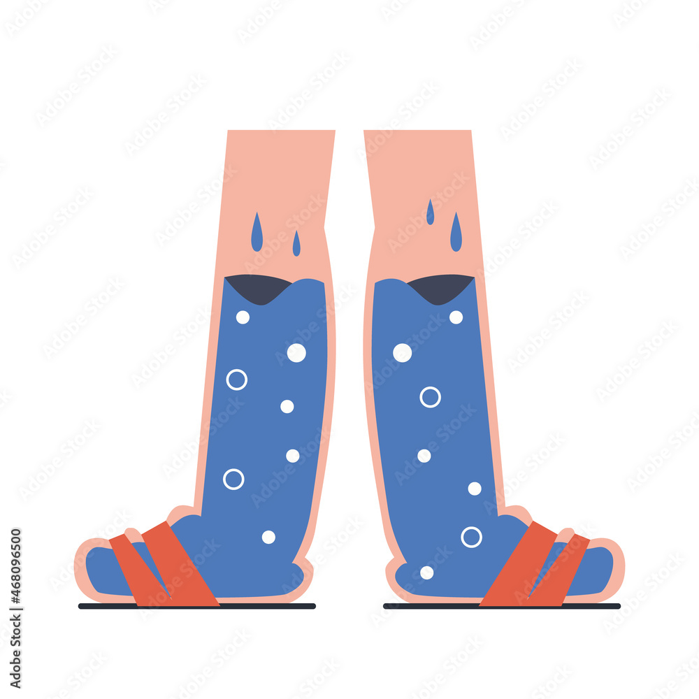 Swelling of the feet. Swollen ankles and feet. Vector illustration ...