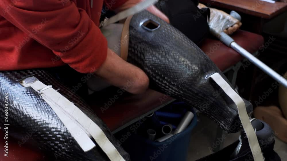 A man living with a disability with amputated legs and arms puts on a ...