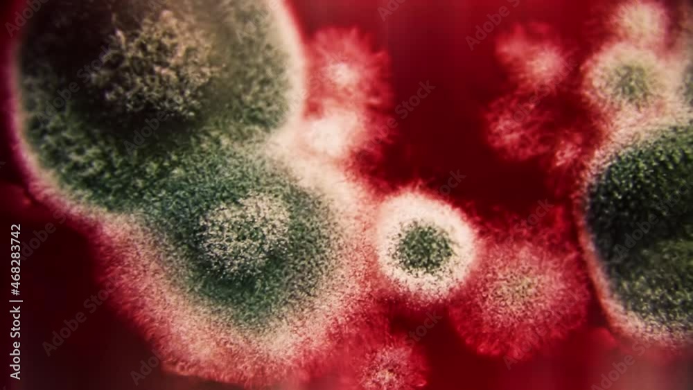 Fungal spores in the liquid. Viral bacterium in the blood.Fungal ...
