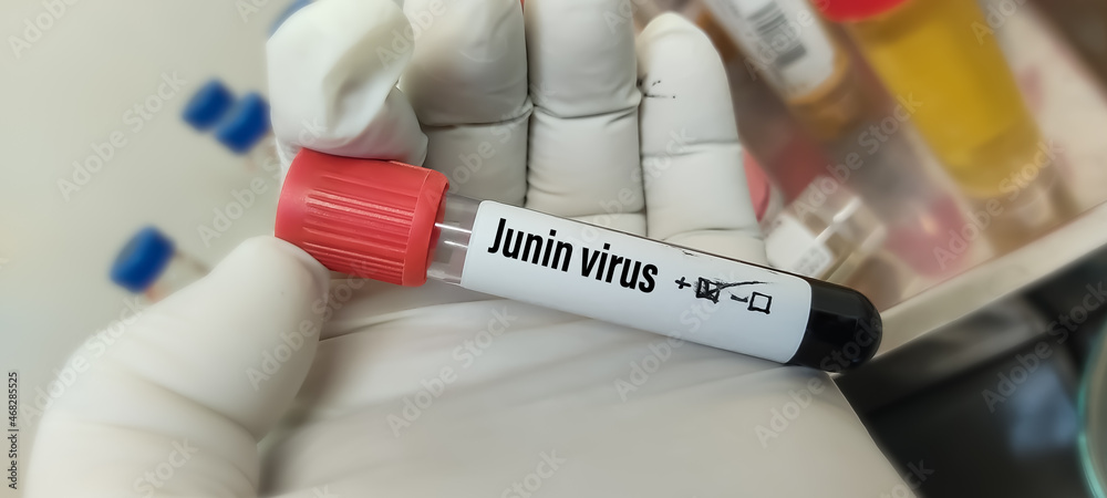 Blood sample for Junin virus test, diagnosis for South American ...