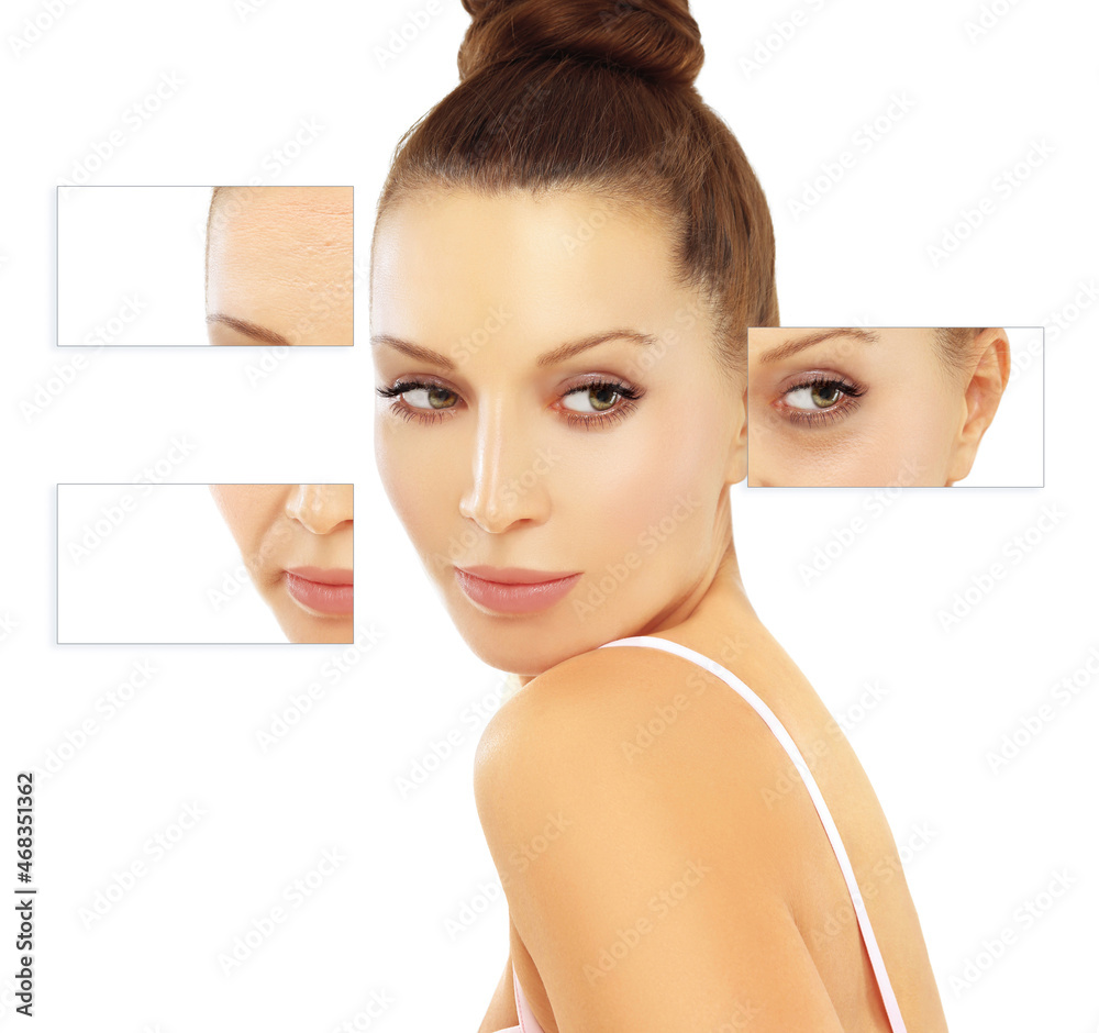 Aging. Mature woman-young woman.Face with skin problem. Stock Photo ...