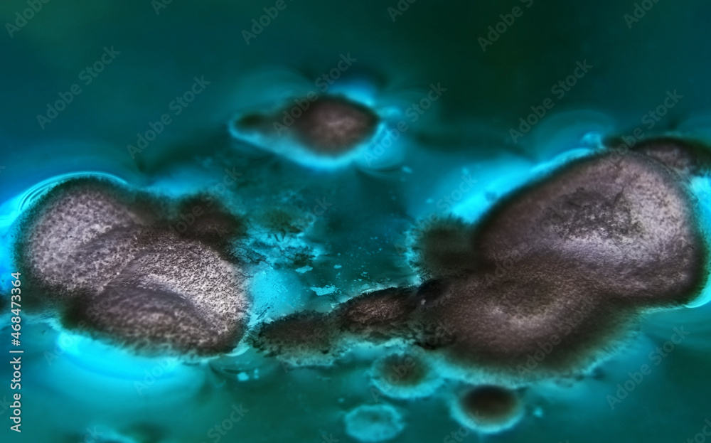 Fungal spores in the liquid. Viral bacterium in the blood.Fungal ...