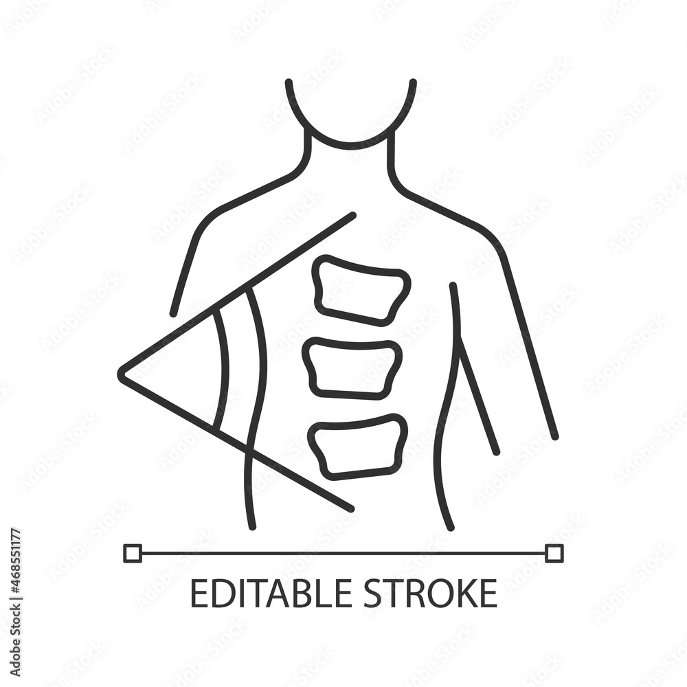 Cobb method linear icon. Cobb angle. Scoliosis degree measurement ...