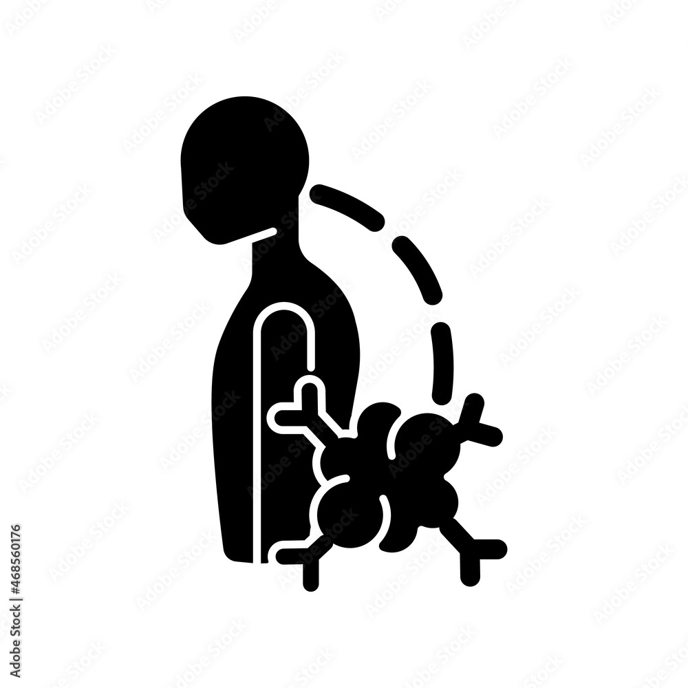 Pathologic scoliosis black glyph icon. Benign bone tumor. Spine ...