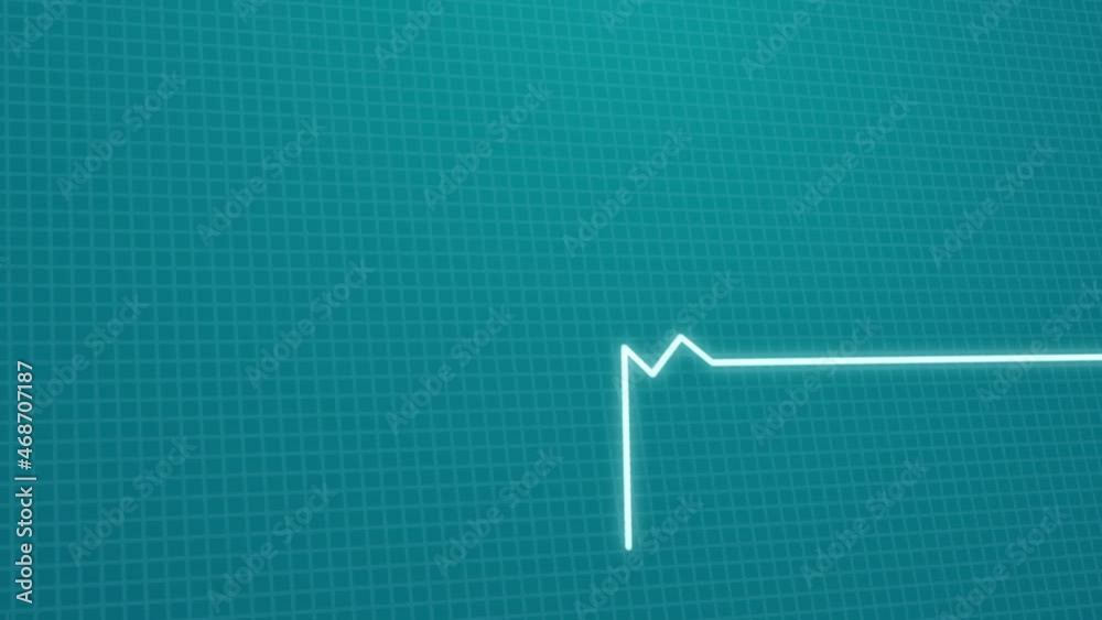 EKG Heart rate electrocardiogram beeping. Medical drama seamless loop ...