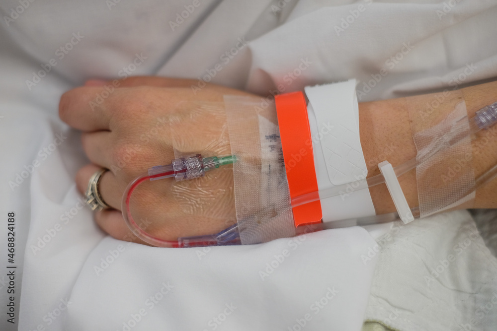 IV intravenous tubes and needle in a Covid infected patient in a ...