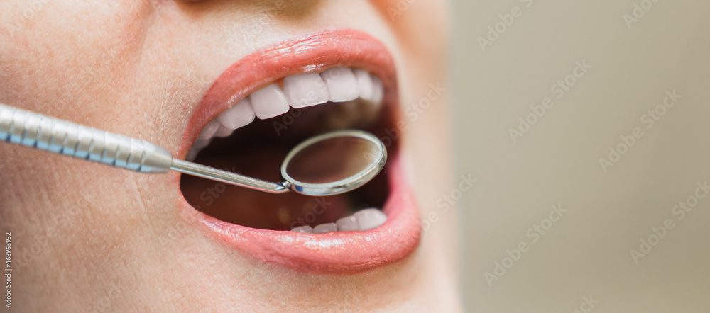 Panorama closeup cropped shot of opened patient`s mouth with healthy ...