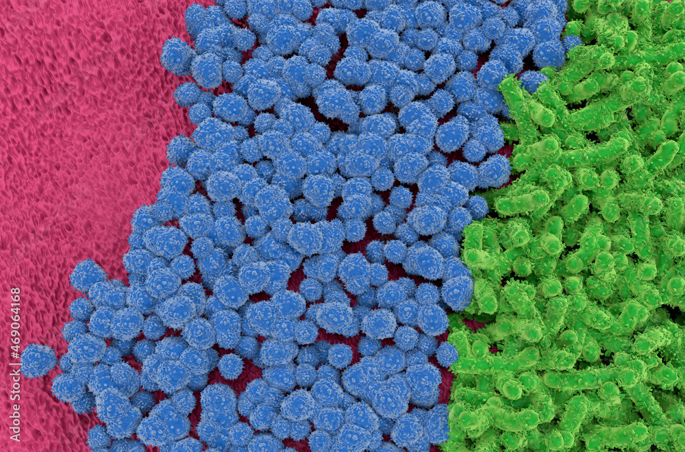 Foot fungus field infection (skin fungal) - top view 3d illustration ...