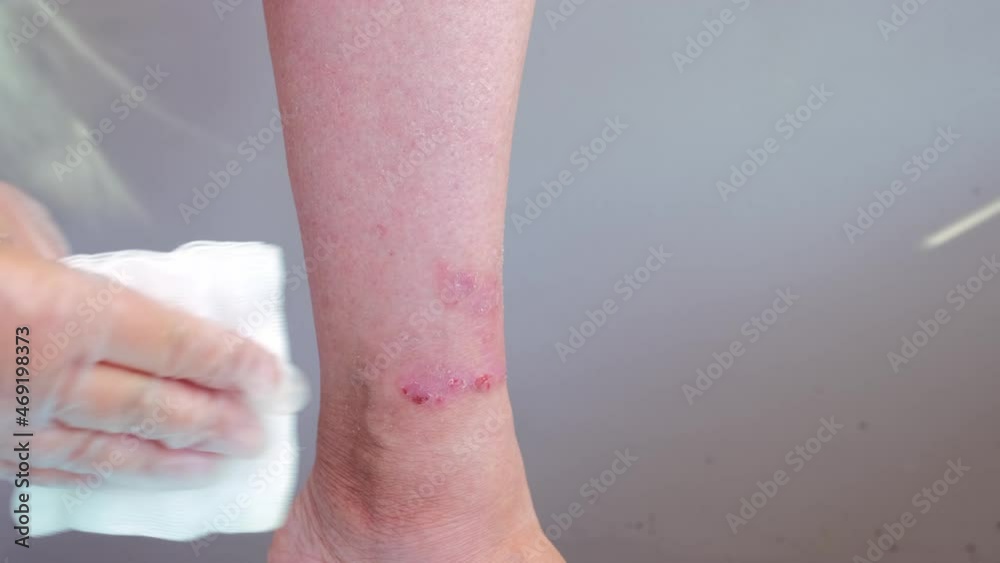 female doctor assistant examines and treats leg woman with scratches ...