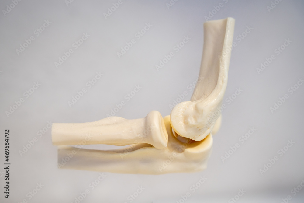 Armknochen, Modell, Oberarm, Unterarm, Skelett, Knochen Stock Photo ...