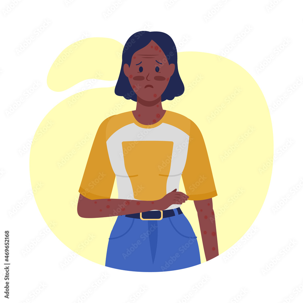 Woman with itchy skin semi flat color vector character. Posing figure ...