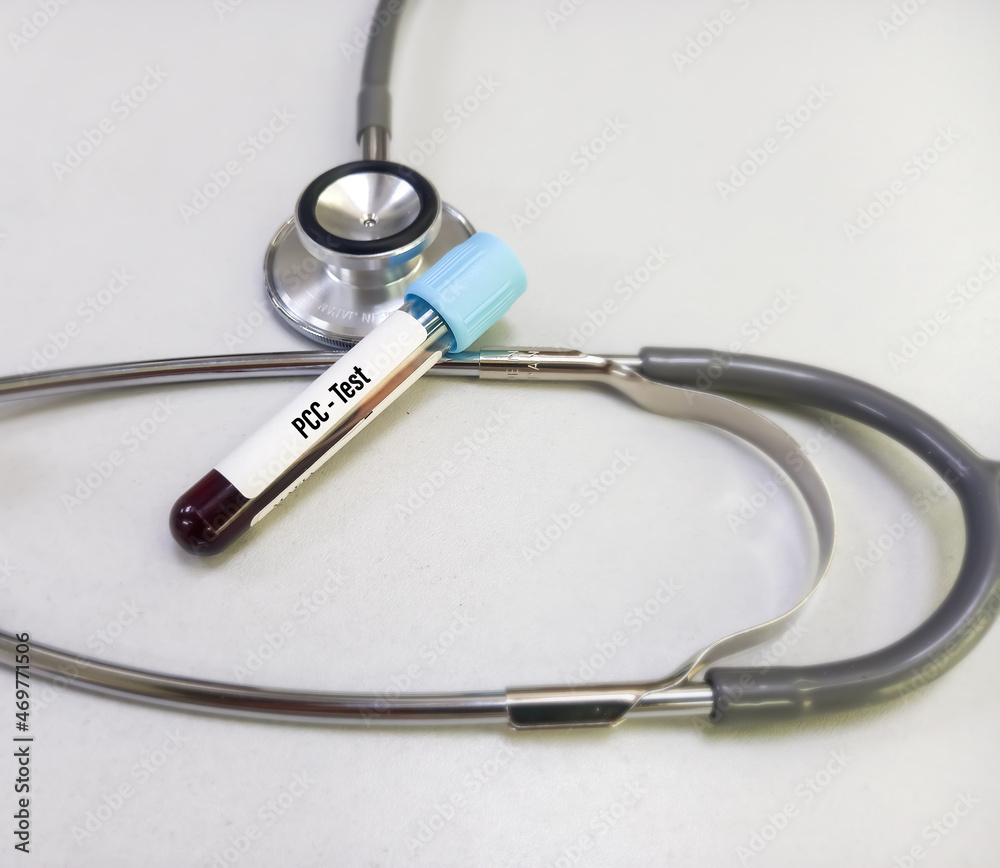 Blood sample for PCC(Prothrombin complex concentrate) test, factor IX ...