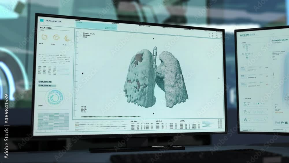 Medical monitoring system is studying the anatomy of a human ...