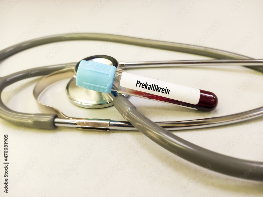 Fotografia do Stock: Blood sample for Prekallikrein (PK) test, also ...