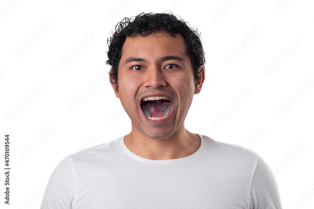 young man with dark skin, mexican, opens his mouth, shows his dental ...