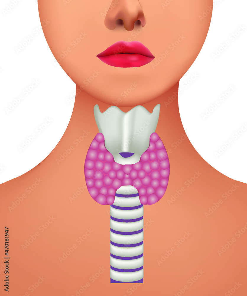 t4, t3, thyroxine, concept, female, sickness, frontal, epiglottis ...