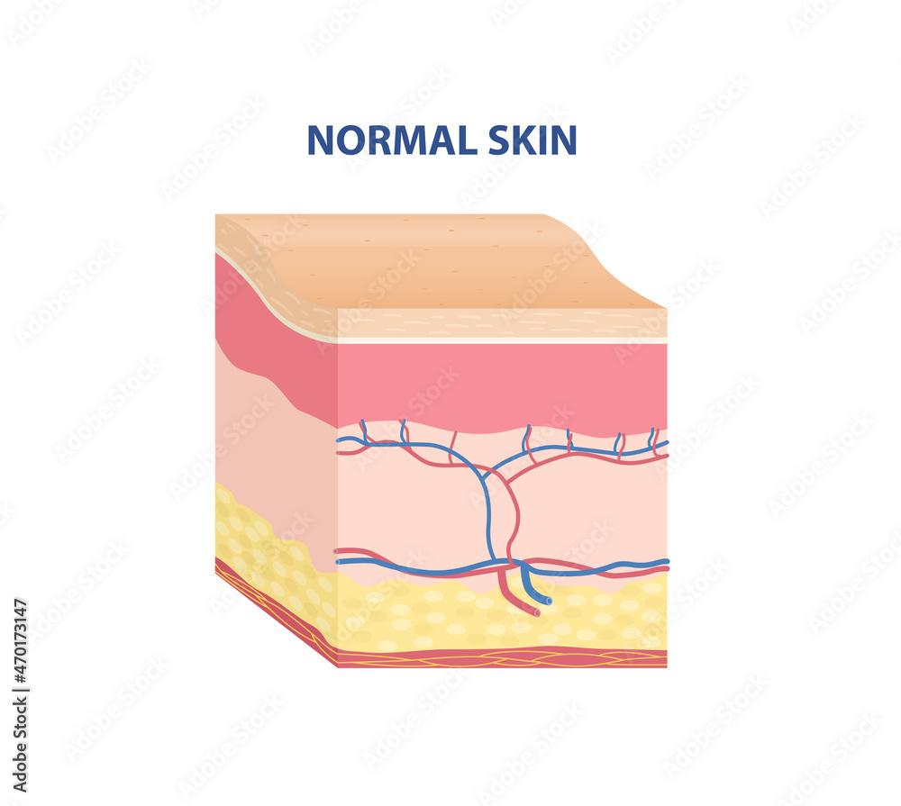 Skin Type Sticker. Normal epidermis without inflammation. Anatomical ...