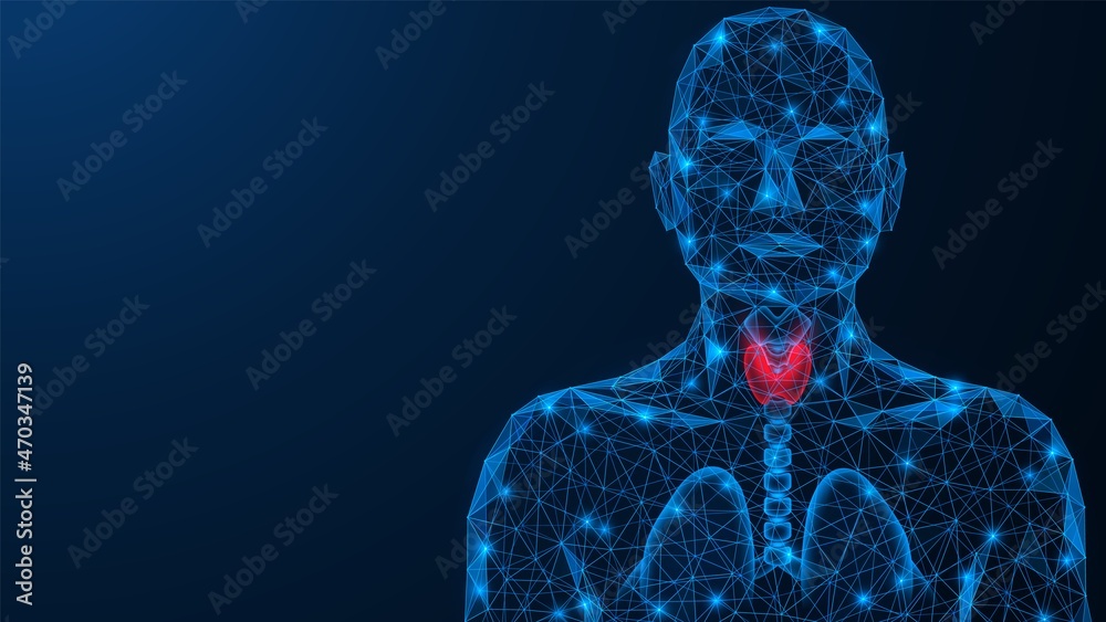 Acute inflammation of the thyroid gland. Low-poly design of ...