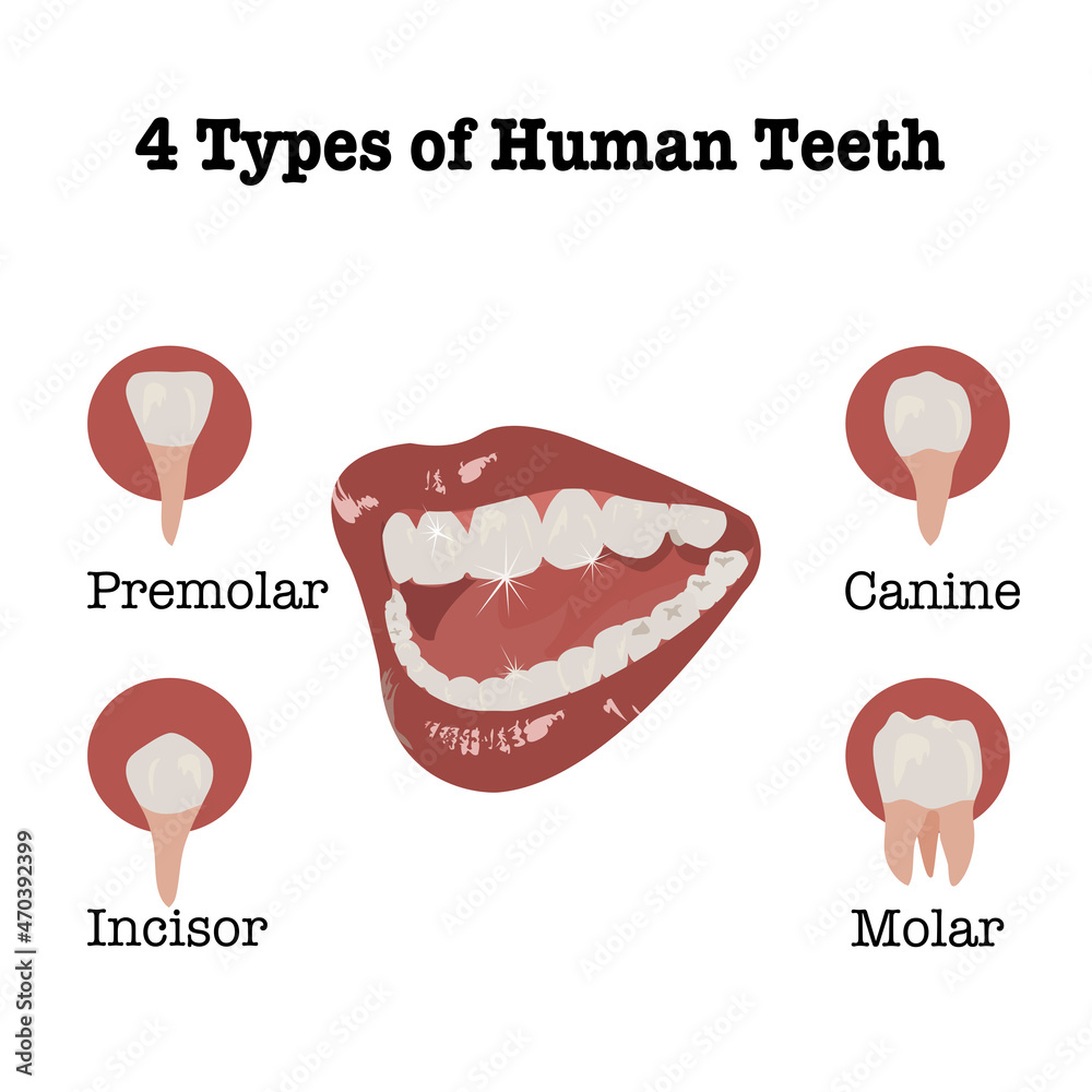 Vector Dental design over white background of Four different Types of ...