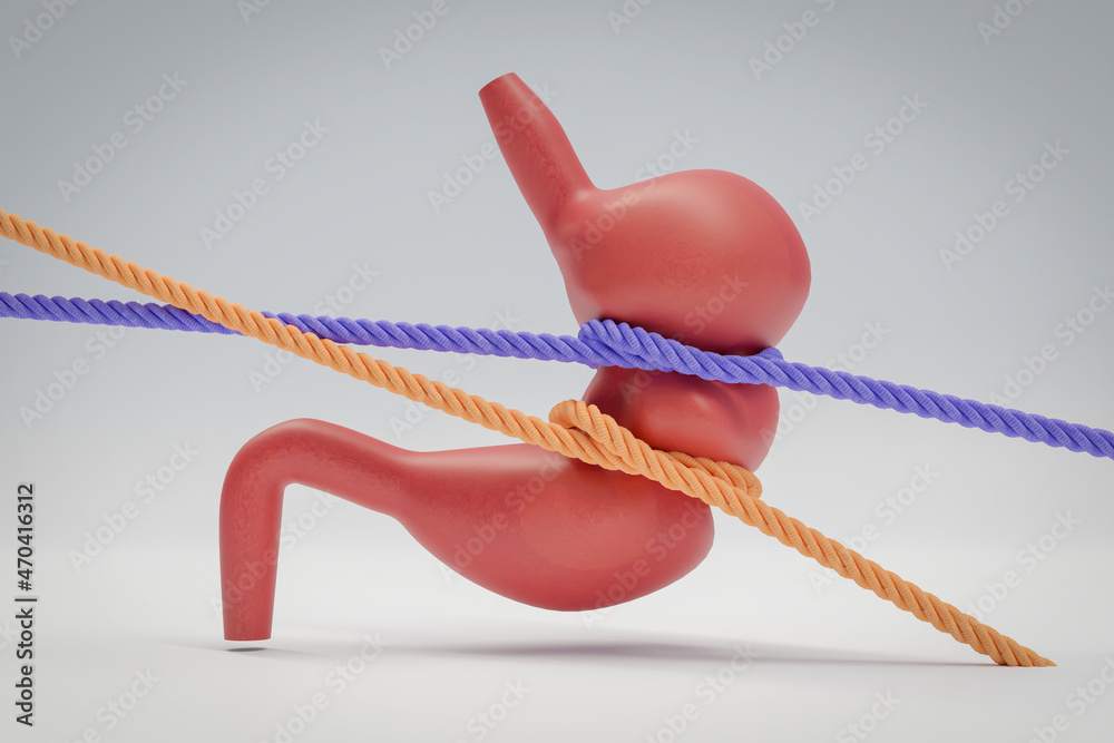 Anatomical model of human stomach, tied with rope. concept for stomach ...