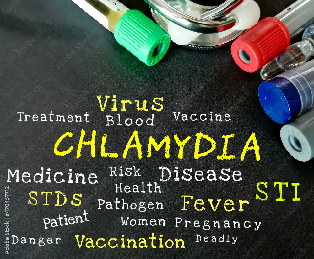 Chlamydia term with word cloud on black background. Medical equipements ...