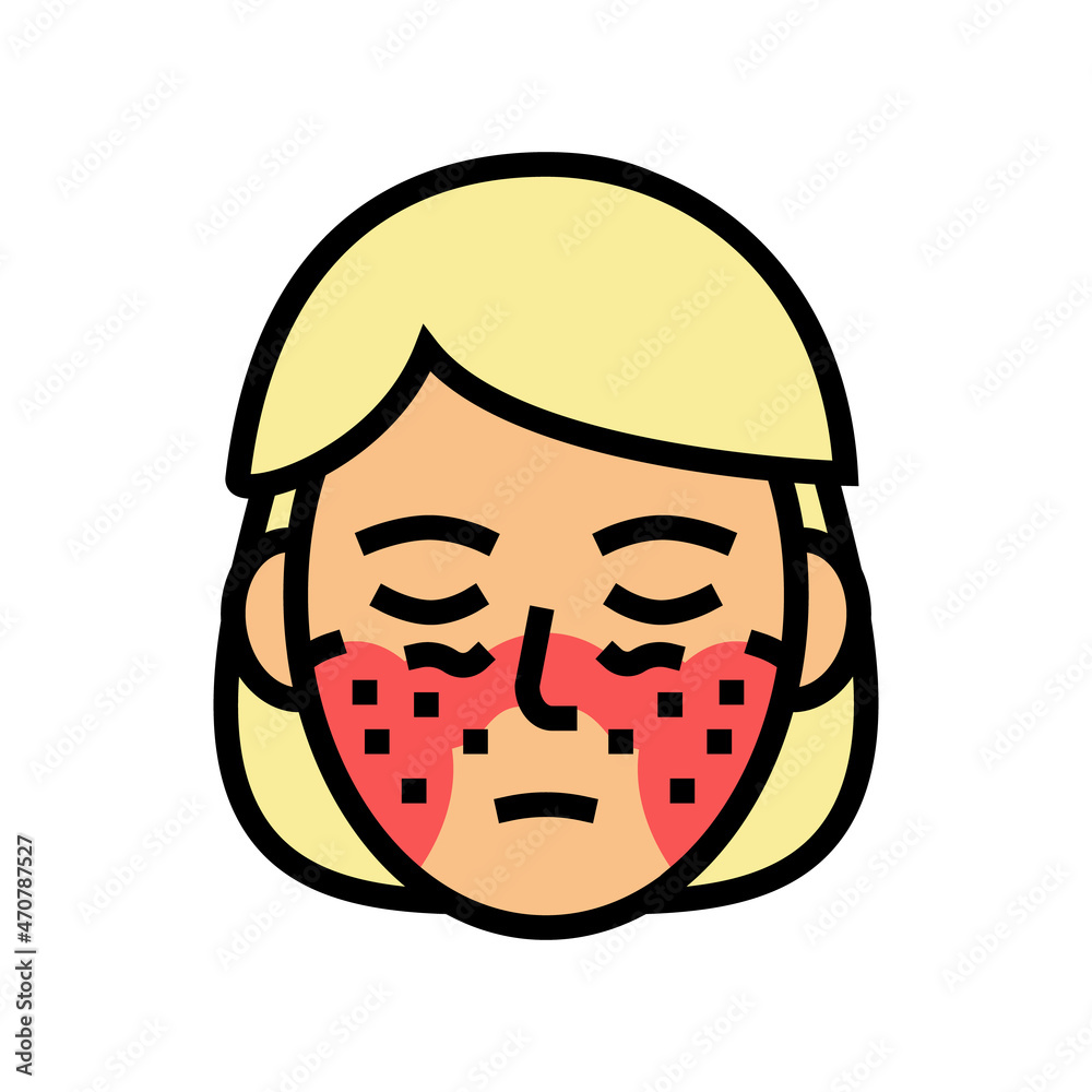 systemic lupus erythematosus color icon vector. systemic lupus ...
