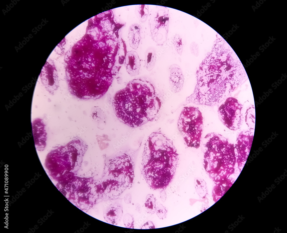 Gram staining, also known as Gram's method, is a method of ...