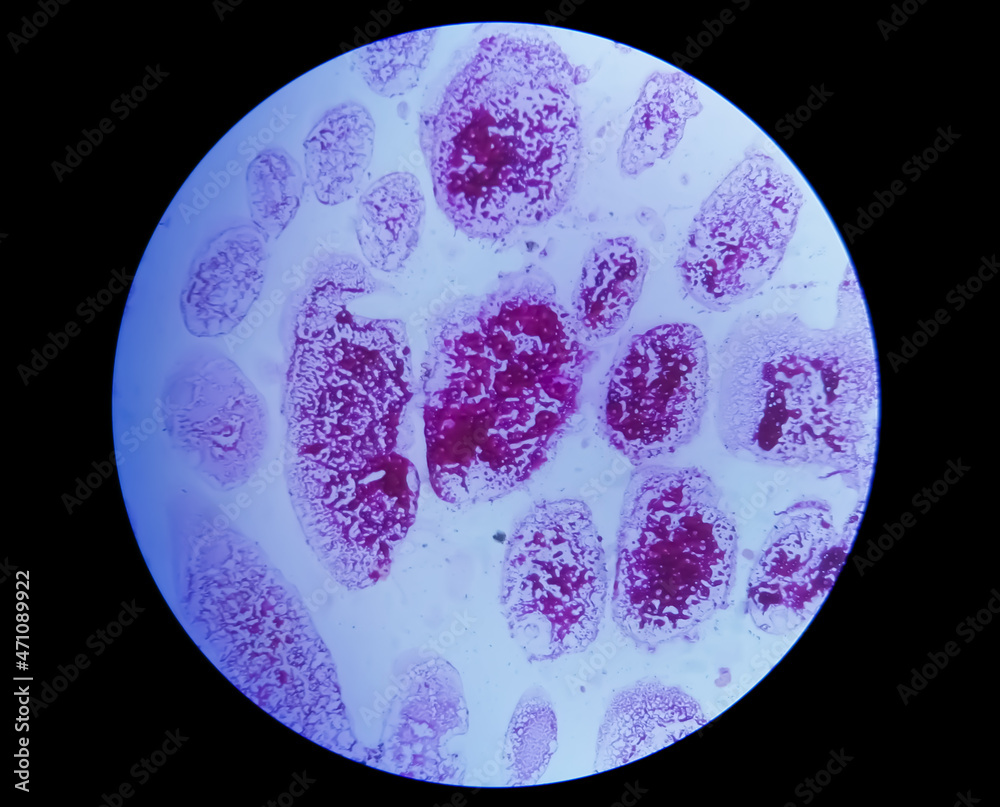 Plakat, Poster Gram staining, also known as Gram's method, is a method ...