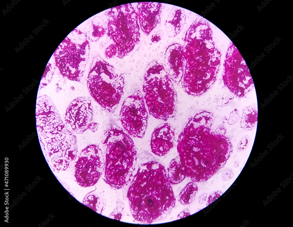 Gram staining, also known as Gram's method, is a method of ...