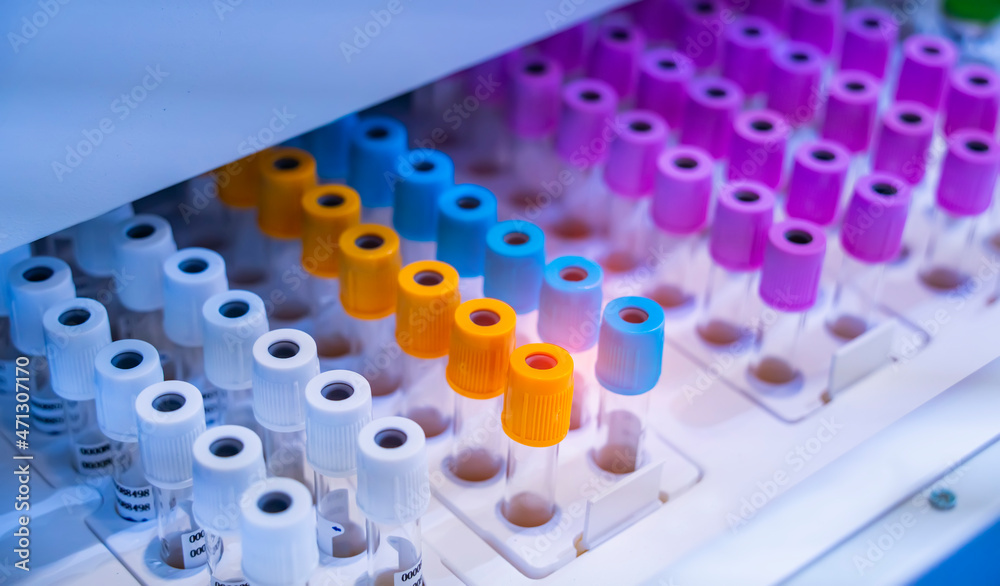 hitech biochemistry laboratory equipment details closeup with test tube ...