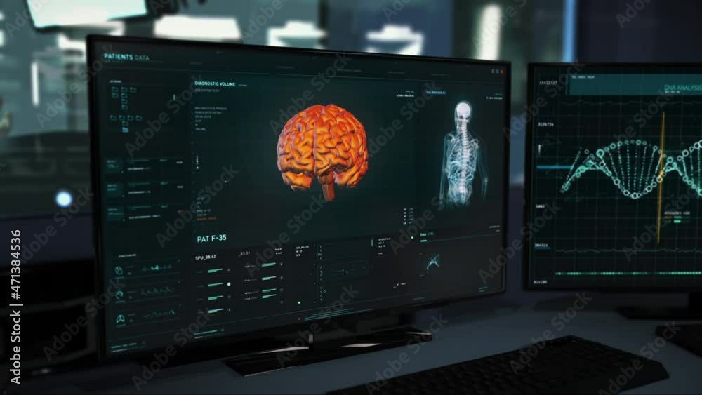 Anatomical Research Brain Scan Medical Technology On Monitor At Modern ...