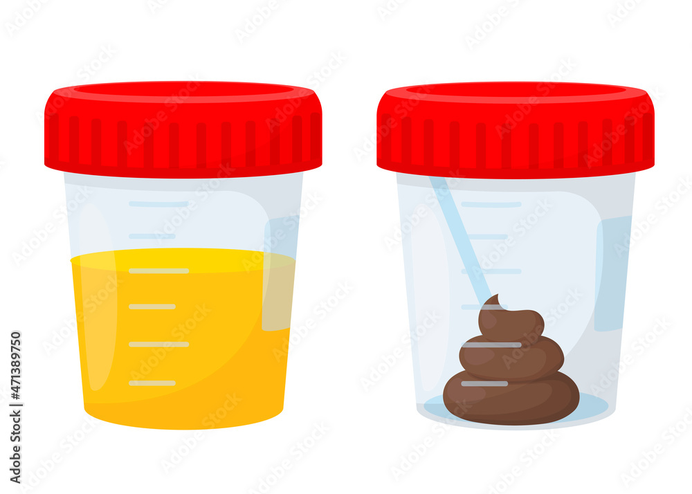 Analysis of feces and urine. Plastic container isolated on white ...