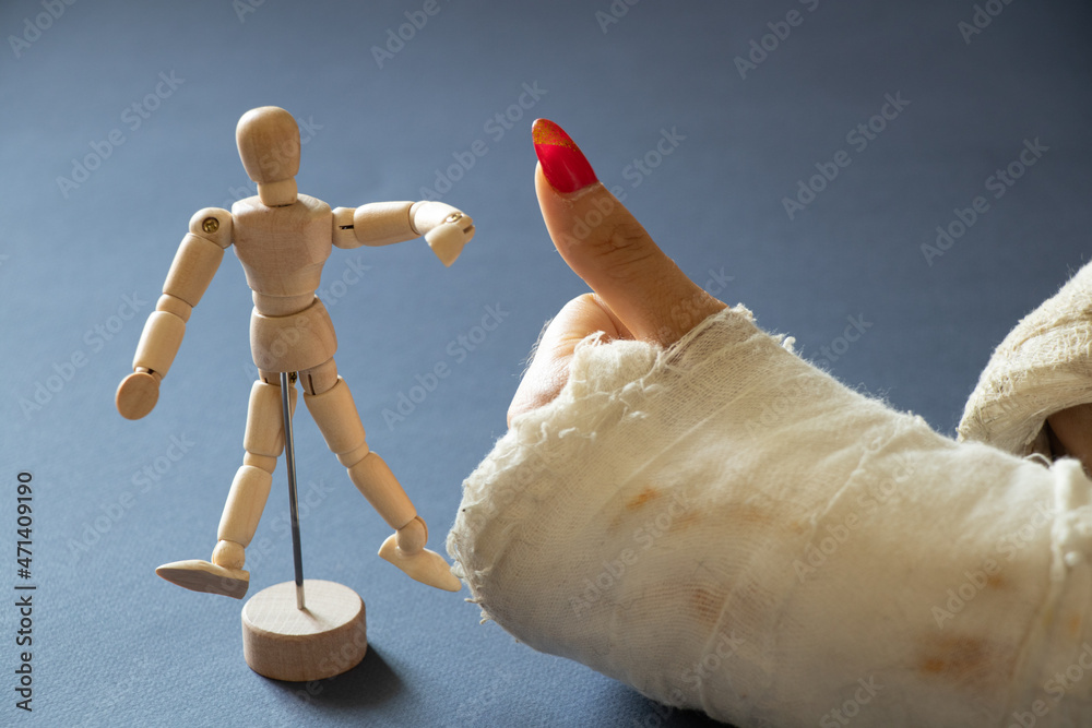 two female hands with broken wrists after falling from a bicycle in a ...