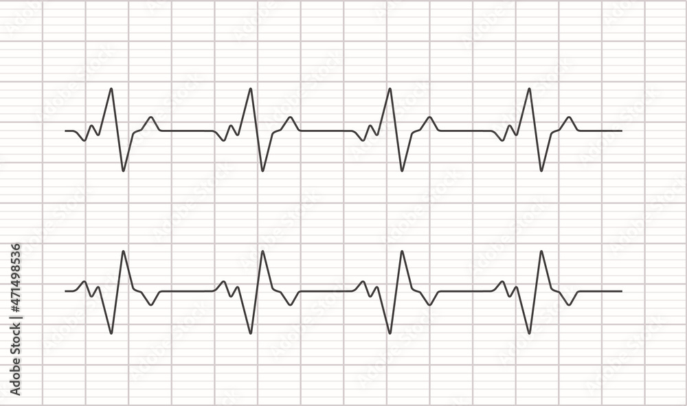 Heartbeat ecg electrocardiogram vector graph wave line. Ekg cardio ...