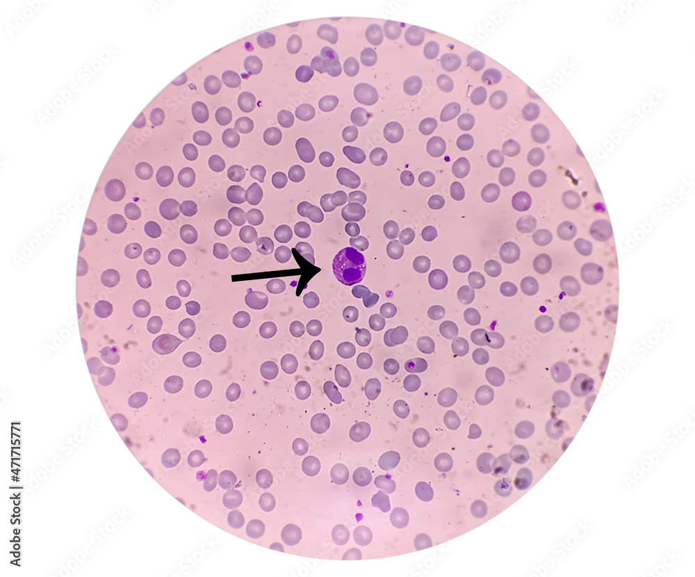 Human blood smear view in microscopy, complete blood count for ...