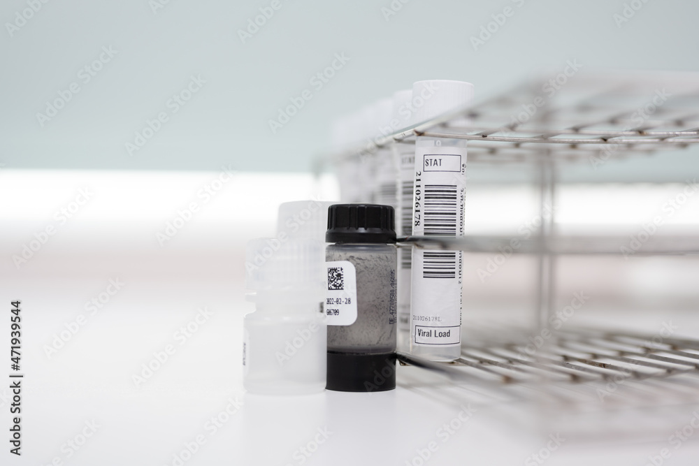Sample specimen in test tube and chemistry and immunology reagent ...