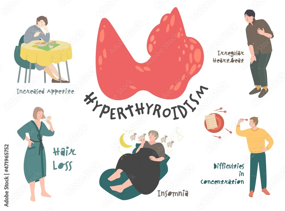 Hyperthyroidism symptoms, thyroid gland disease. Hyperthyreosis signs ...