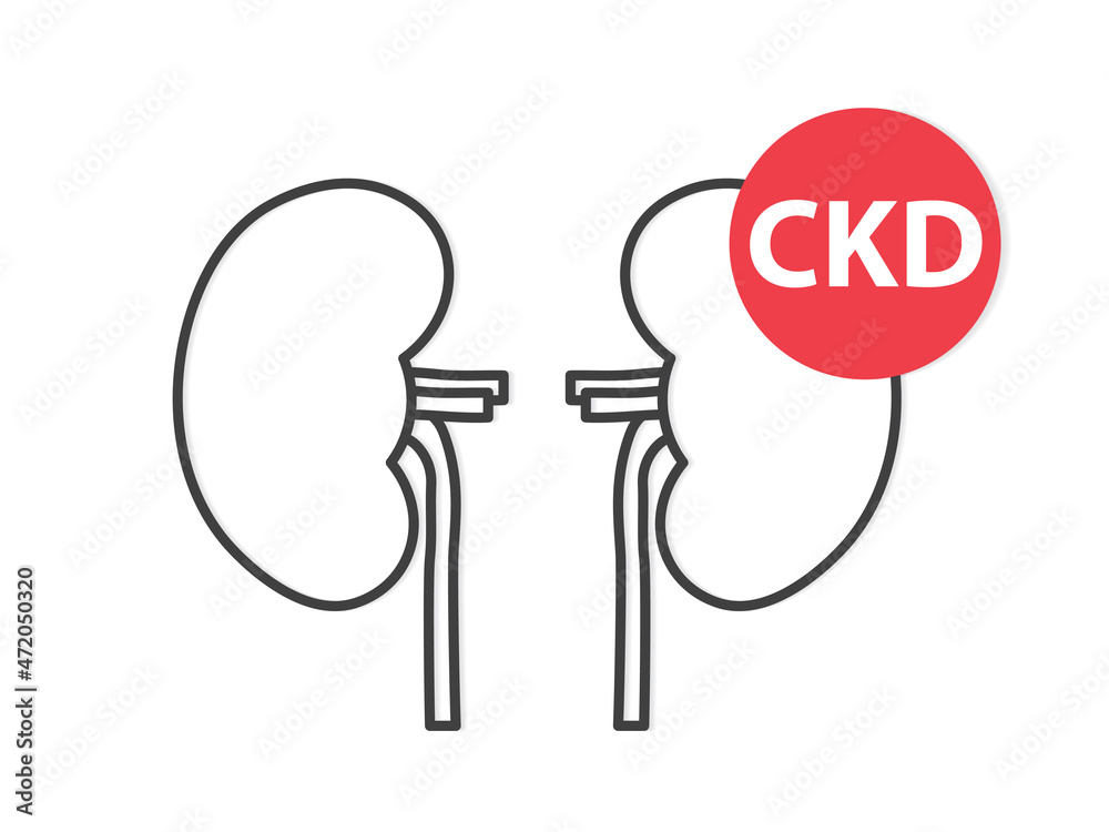 CKD (Chronic Kidney Disease) acronym and kindey outline- vector ...