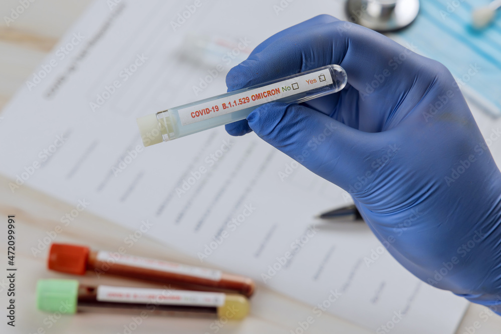 Tube containing a sample Coronavirus COVID-19 new version Omicron test ...