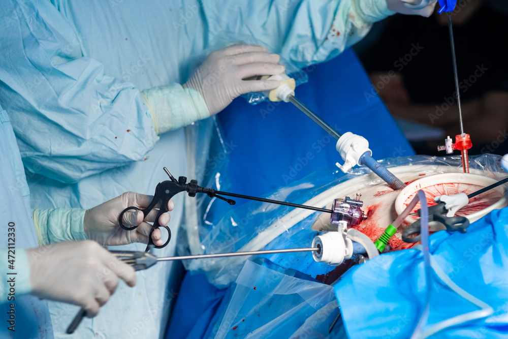Side view of the hands of surgeons in sterile gloves working with ...