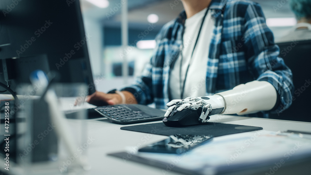Foto de Diverse Office: Person with Disability Using Prosthetic Arm to Work on Computer ...