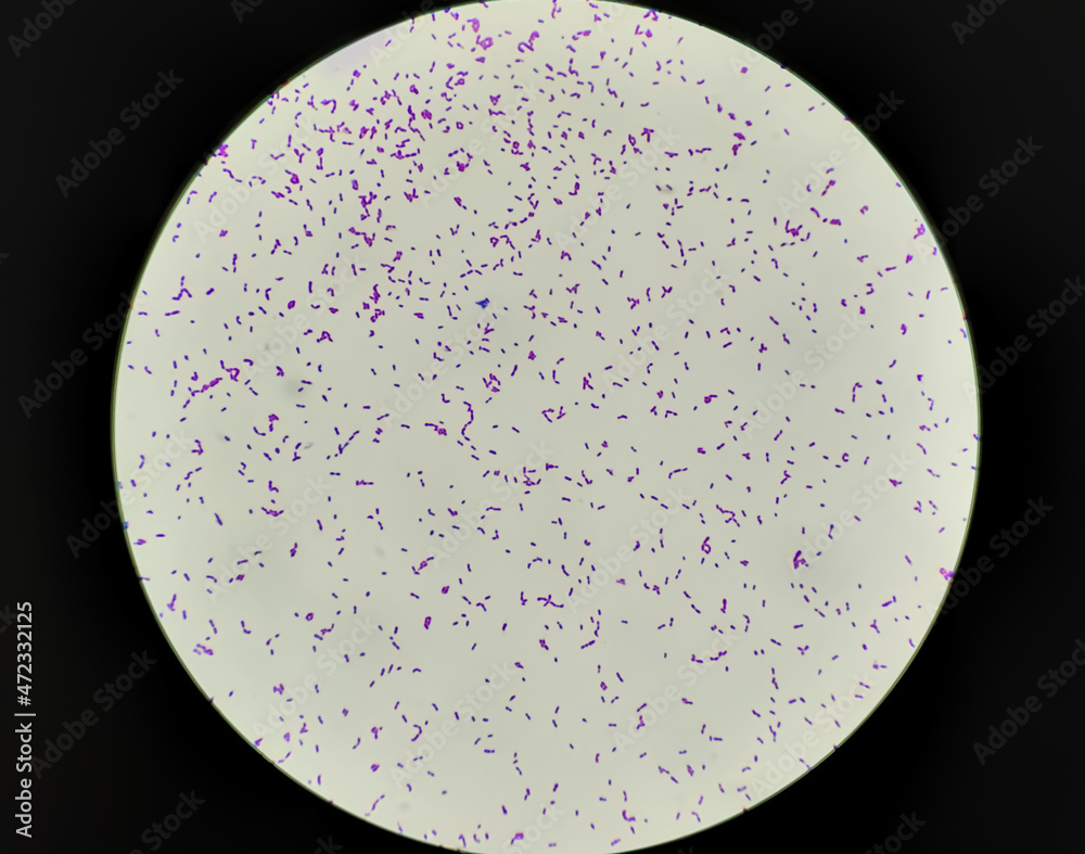 Bacteria Enterococcus isolated on white background micrograph. Gram ...