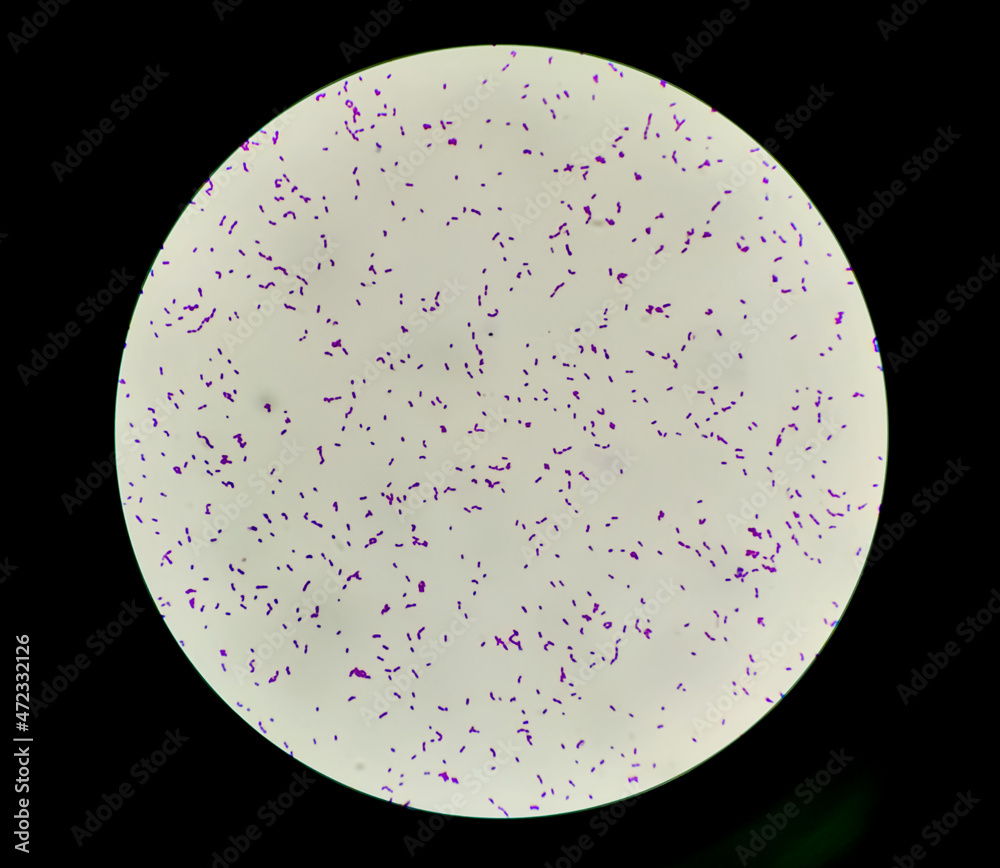 Bacteria Enterococcus isolated on white background micrograph. Gram ...